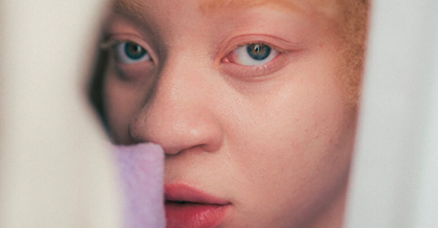 Tim van Wolfswinkel - Cases